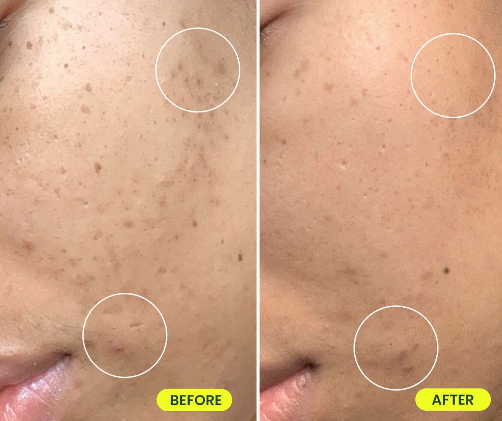 Urban Skin Rx - Skin Care From The Melanin Experts